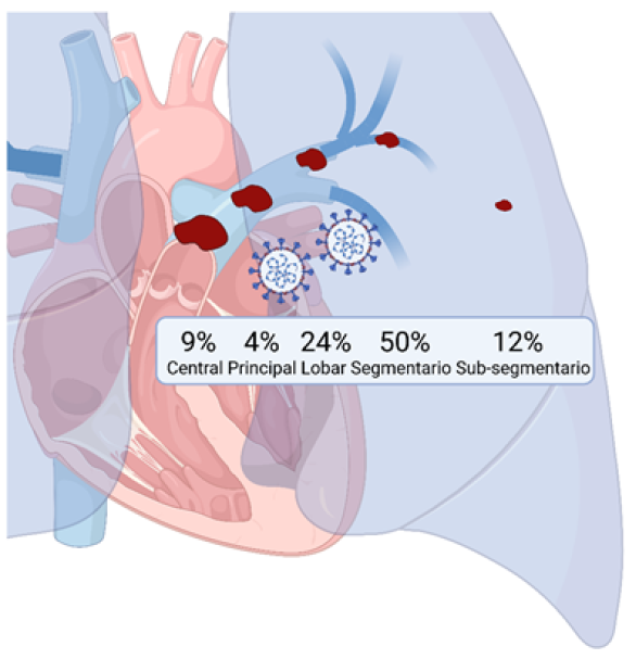 Diagrama De Embolia Pulmonar